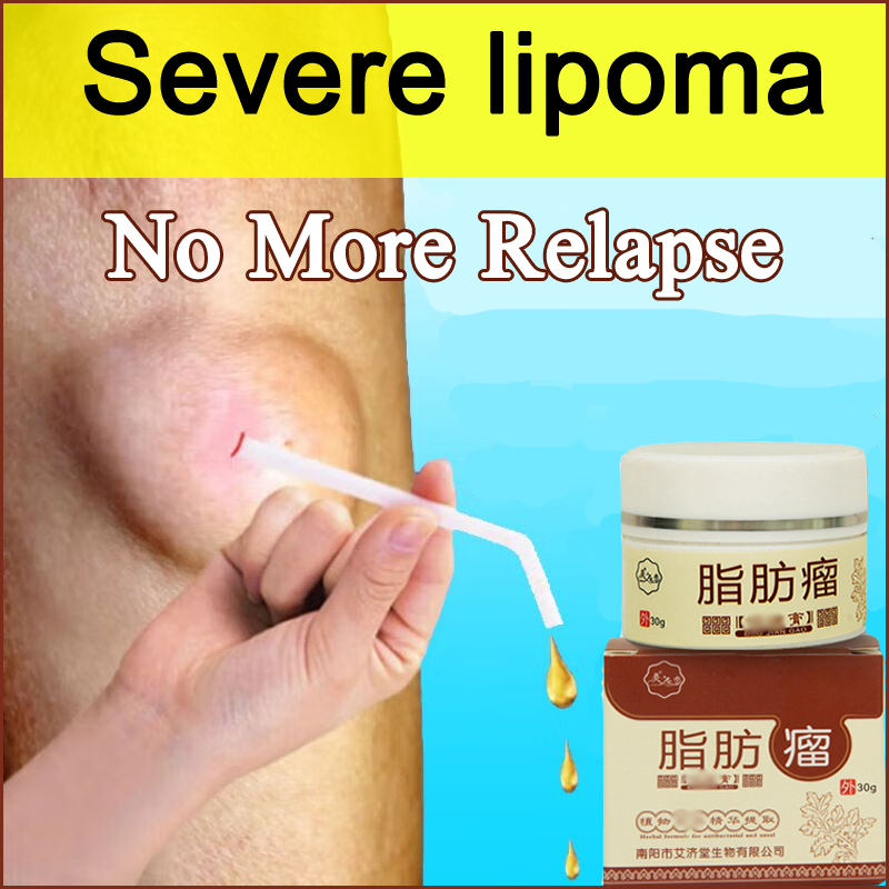 Lipoma Removal Cream 30g Fat Dissolving And Eliminating Fat Spray ...