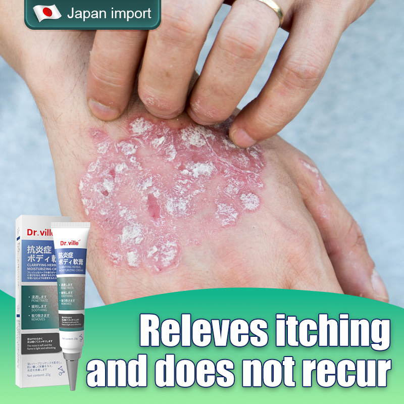 Japanese Herbal Anti-inflammatory Clearing Cream Skin Cream Stop Itchy Peeling Moss Cure Eczema ...